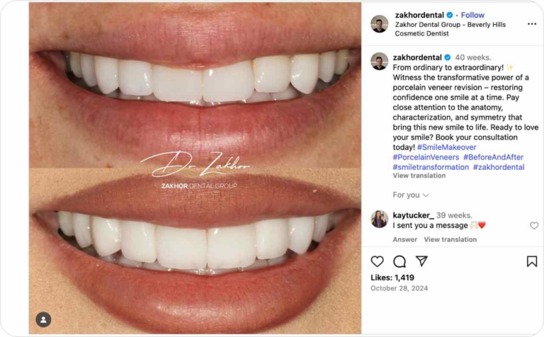 Dental advertising in 2026: 5 types ads with examples - Zeely AI