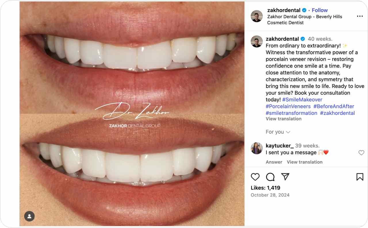 Dental advertising in 2026: 5 types ads with examples - Zeely AI